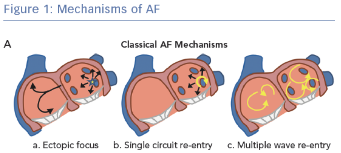 Localized AF Drivers - Personalize AF